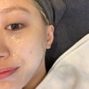 선릉역 피부관리 꼼에스테틱에서 셀리케어 받고 왔습니다 ~ 네이버 블로그